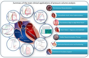 PV Loop Medical Devices - CD Leycom